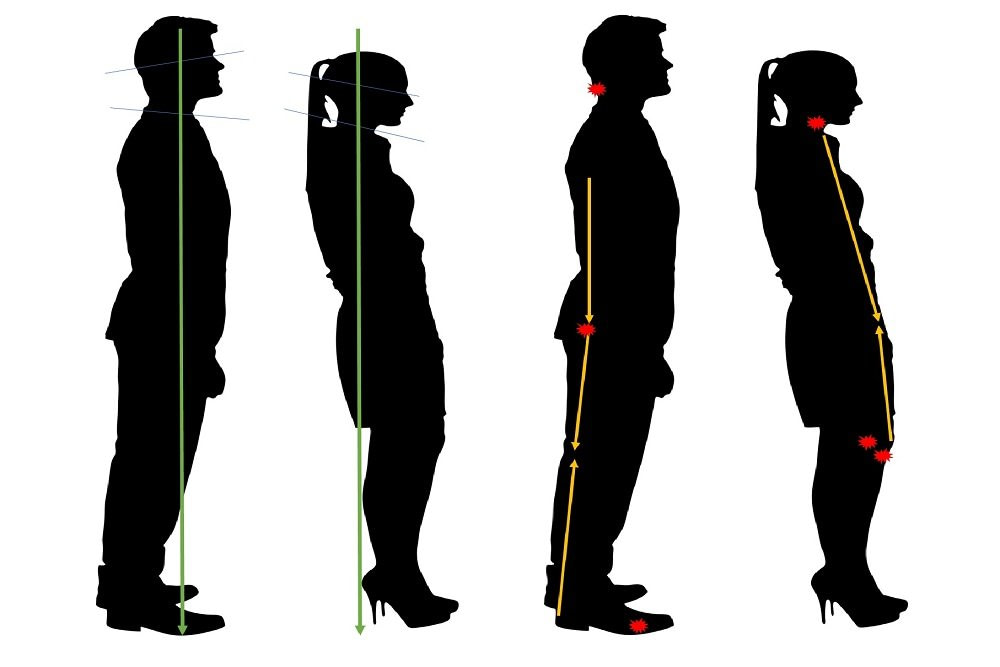 Rolfing 10 Series - Goals and Implementation - Rolfing Praxis